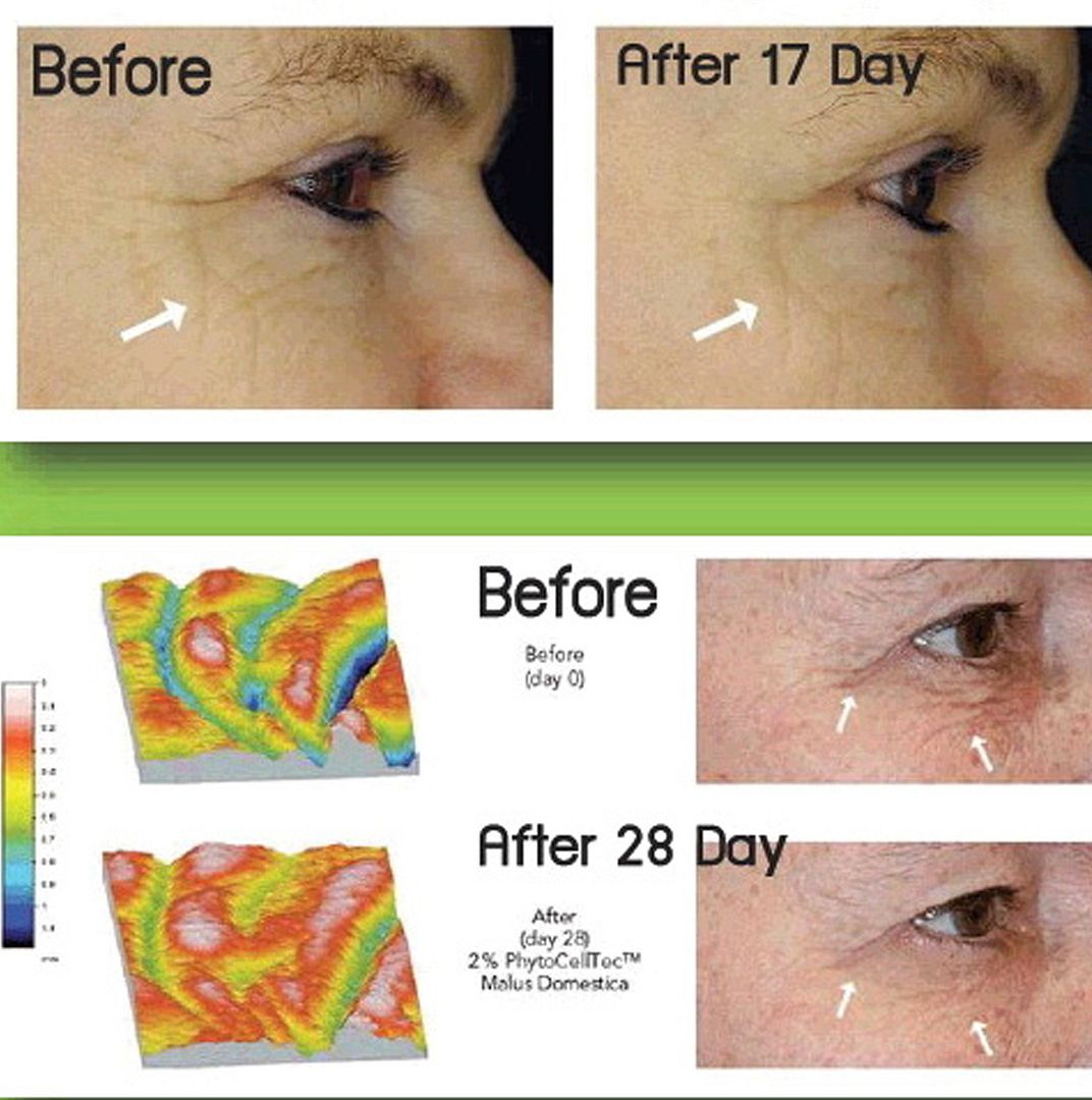 15m DIY 100% PhytoCellTec™Apple Stem Cell Extract Serum Booster,Rebuild ... 15m DIY 100% PhytoCellTec™Apple Stem Cell Extract Serum Booster,Rebuild ...